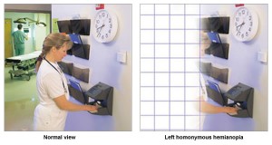 Homonymous Hemianopia | Stroke4Carers